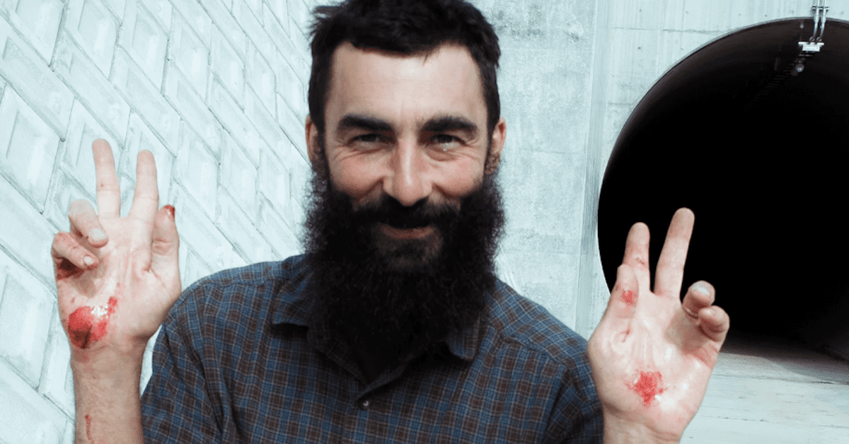 Nick Boserio Shares "The Gnarliest Road Rash I've Ever Gotten" And More ...