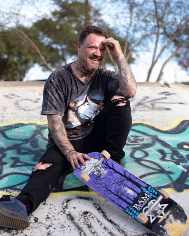 The Unleashed Clip of Bam Margera Tearing His MCL