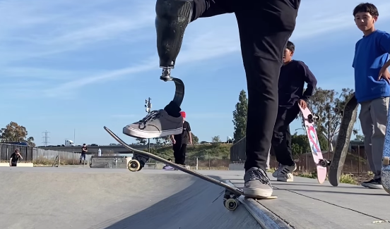Inspiring Resilience: One-Legged Skater Pulls Off A Trick Most Others ...